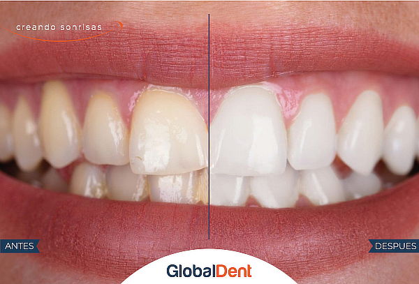 Cuponatic: Miles de Ofertas con hasta 90% Descuento