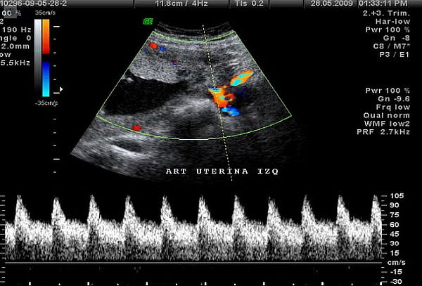 Ecografía Doppler fetal, 3D + Imagen a Color + | Cuponatic